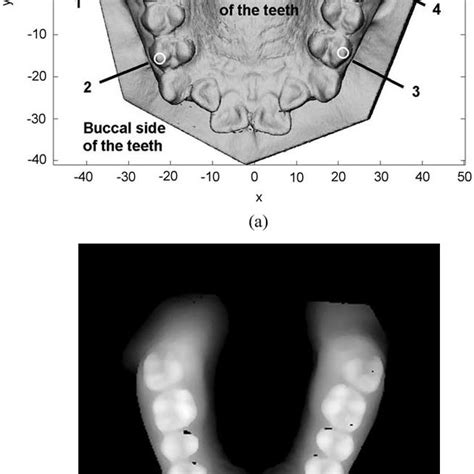 Pdf Tooth Segmentation Of Dental Study Models Using Range Images