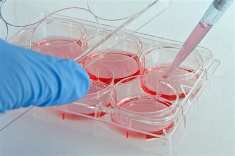Ahsct Autologous Hematopoietic Stem Cell Transplantation In Ms