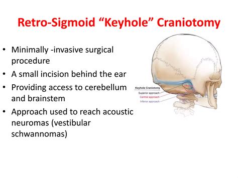 Craniotomy Pptx