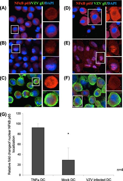 Cellular Localization Of Nf B P65 Protein Subunits Determined By Download Scientific Diagram