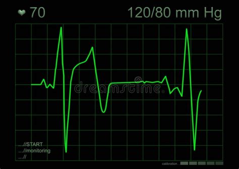 ECG Graph Stock Illustration Illustration Of Cardiology