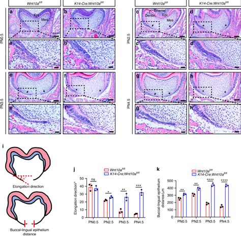 A Wnt10a Notch Signaling Axis Controls Hertwigs Epithelial Root Sheath
