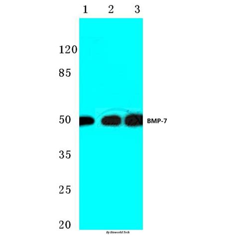 Anti Bmp 7 E173 Antibody A27087