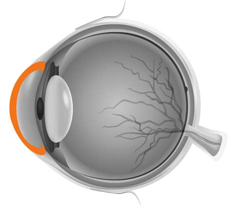 Cornea And Anterior Segment Disease Inner Shantilal Shanghvi Eye