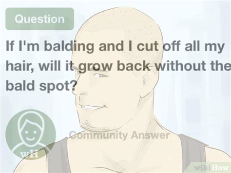 How To Tell If You Re Going Bald Scrolller