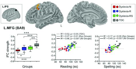 Atypical Ifc Between The Left Intraparietal Sulcus L Ips And Left Download Scientific Diagram
