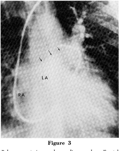 Figure 3 From Radiologic Notes In Cardiology Use Of The Contras
