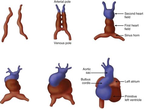 Embryology Of The Cardiovascular System Radiology Key