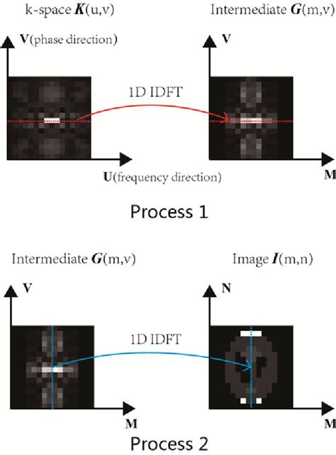 Figure 3 From Aliasing Artefact Suppression In Compressed Sensing Mri