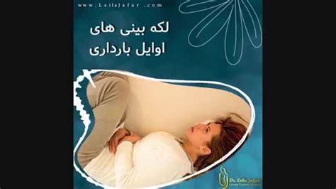 توضیحات دکتر لیلا جعفری در مورد لکه بینی های اول بارداری نماشا