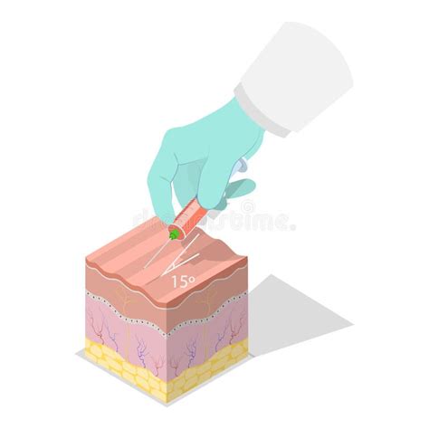 3d Isometric Flat Vector Illustration Of Types Of Injections Item 4 Stock Illustration