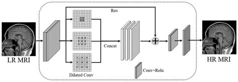 Magnetic Resonance Reconstruction Method Of Super Resolution