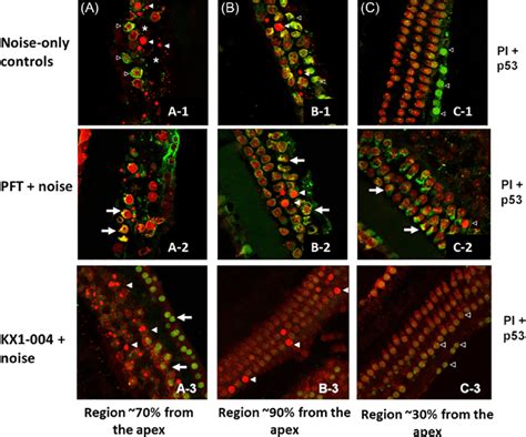 Color Online Cochlear Samples Double Stained With Phospho P53 Ser