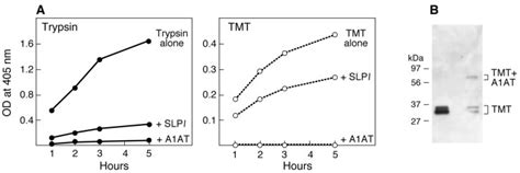 Susceptibility Of Human Tmt To A1at And Secretory Leukocyte Protease