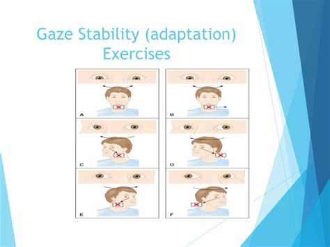 Lect 15 Vestibular Rehabilitation Pptx