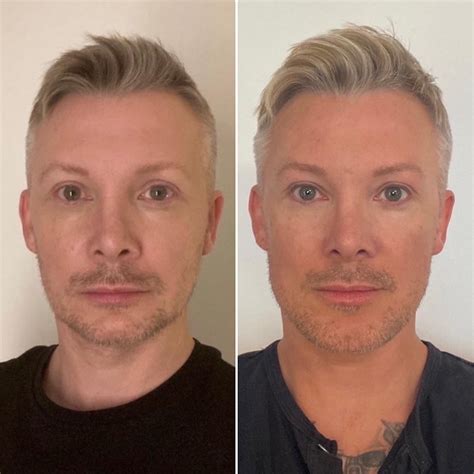 Male Aesthetics Wood Medispa