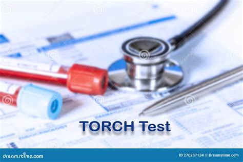 Torch Test Testing Medical Concept Checkup List Medical Tests With