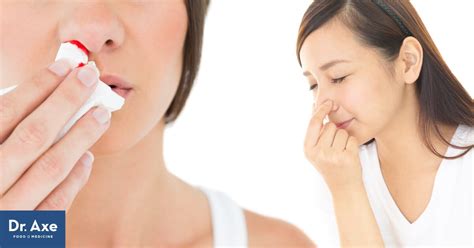 How To Stop A Nosebleed 4 Home Remedies Prevention Dr Axe