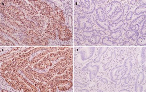 Figure 1 From Clinical Significance Of Mlh1msh2 For Stage Iiiii