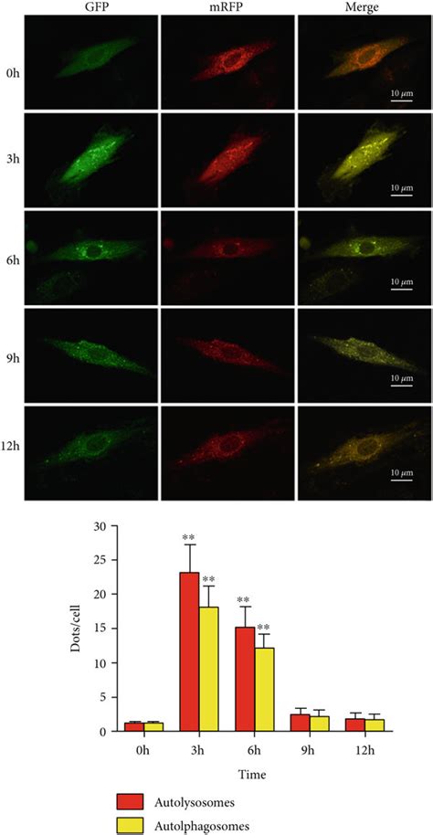 Autophagic Vacuoles And Autophagic Flux Determined By Tem And Confocal