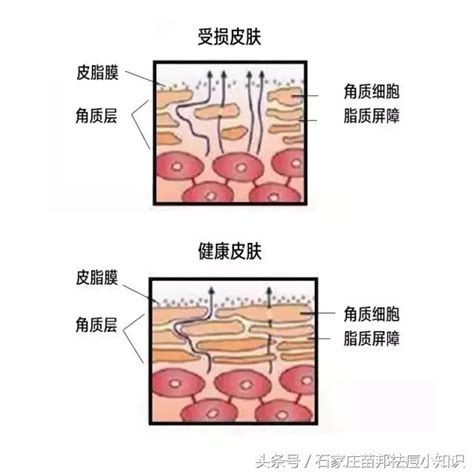 只是過敏嗎？！1分鐘教你辨別「皮膚屏障受損」 每日頭條