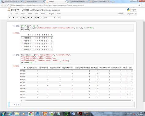 Breast Cancer Detection Using Classification Algorithms By Sravanthi