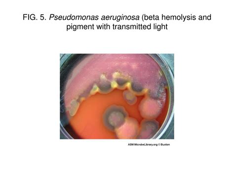 Ppt Laboratory Methods For Diagnosis Of Non Fermenting Gram Negative