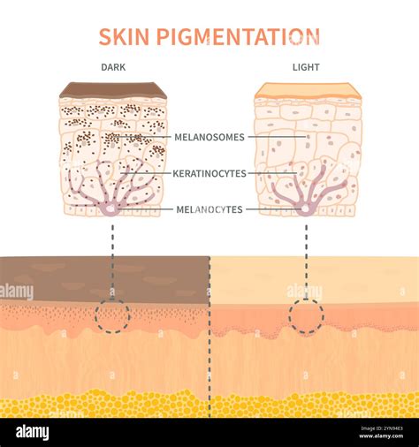Melasma Pigmentation Stock Vector Images Alamy