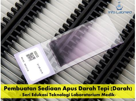 Pembuatan Sediaan Apus Darah Tepi Darah
