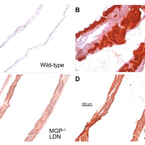 Representative Dissection Of An Aorta From A Wild Type Mouse A A Download Scientific Diagram