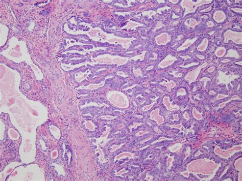 Bartholin Gland Histology