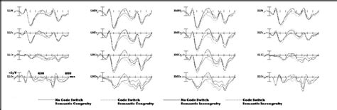 Erp Waveforms Raw Waveforms Are Presented For Each Condition Download Scientific Diagram