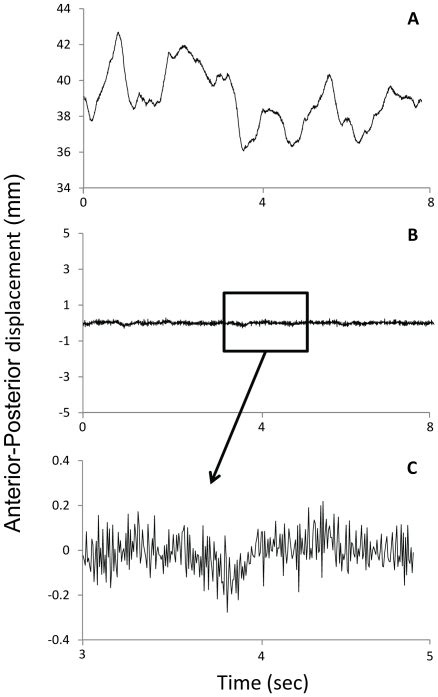 Example Plot Of The Original Center Of Pressure Cop Time Series From