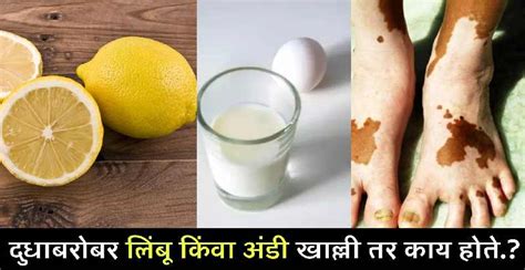 दूध पिल्यानंतर जर कोणी लिंबू किंवा अंडी खाल्ली तर शरीरात काय होत असते