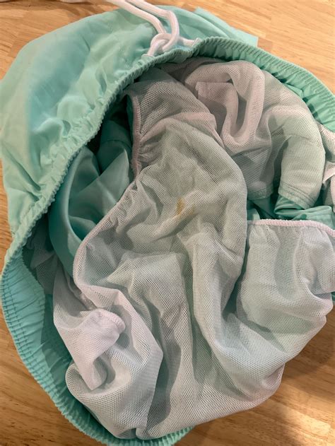 New” Swim Trunks I Bought Off Amazon From Amazon Basics Have A Literal