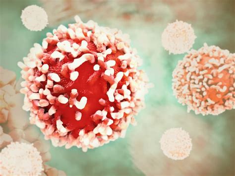 Report Finds Seventy Percent 5 Year Survival Rate For All Cancers