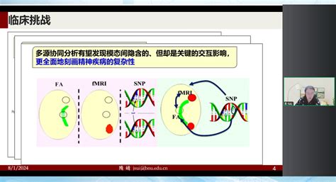 【脑客中国·科研】隋婧：多模态磁共振影像融合计算方法及其在神经精神疾病的临床应用 深圳瀚翔脑科学技术股份有限公司