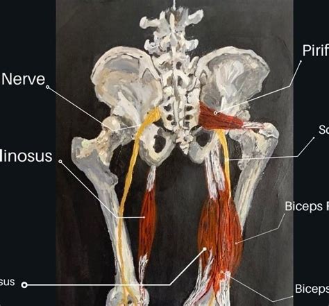 High Proximal Hamstring Tendinopathy Risk Factors 52 Off