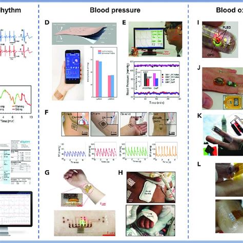 Wearable Sensor Detection Of Cvds A Ecg Detection Using Dry