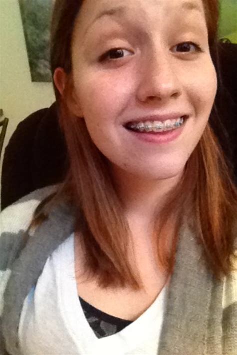 Sexy Girls With Braces On Tumblr