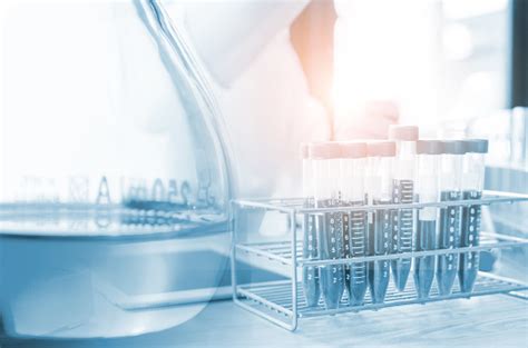 테이블에 랩에서 Vacutainer 또는 테스트 튜브 Stem 주제에 대한 스톡 사진 및 기타 이미지 Stem 주제 갑상샘