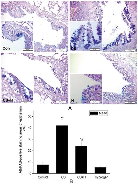 Effect Of Hydrogen On Goblet Cell Hyperplasia Of The Bronchial