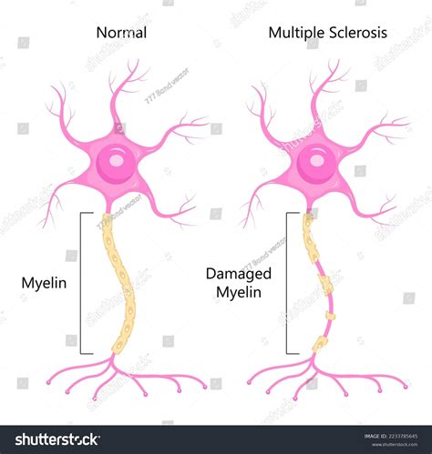 Neuron Concept Vector Dendrite Axon Soma Stock Vector Royalty Free