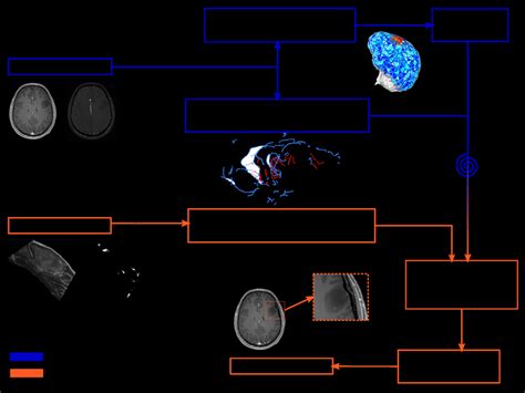 3 Pipeline Of The Brain Shift Correction Method Download Scientific