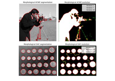 Module Segmentation Skimage V Docs