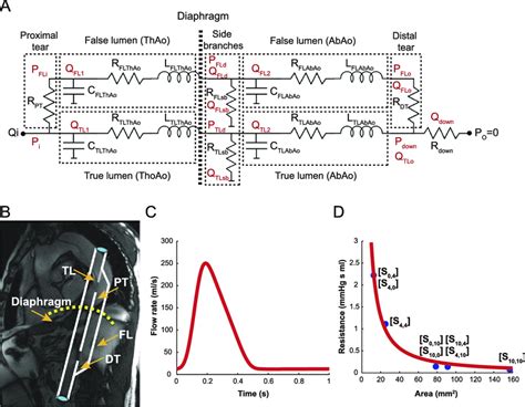 lumped parameter computational model of an aortic dissection a