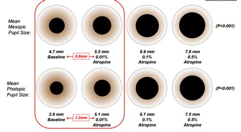 Pupil Size Chart Normal Range
