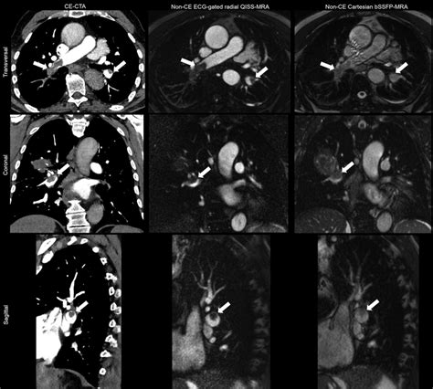 Exemplary Views For The Evaluation Of Arterial Visualization And