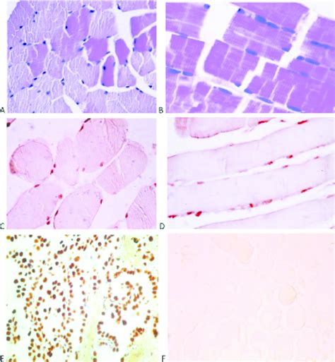 Immunohistochemical Localization Of PELP Protein Expression In