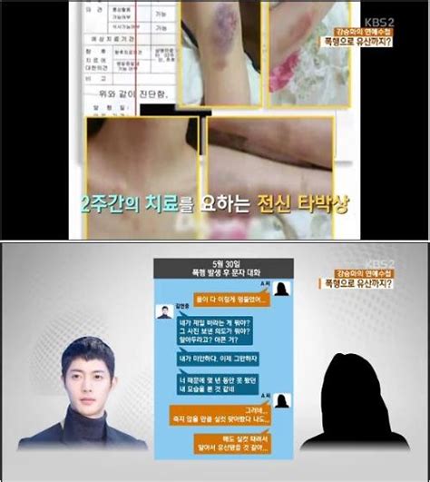 김현중 전 여친 폭행사진 보니“죽지않을 만큼 맞아유산된 것 같아” 아주경제